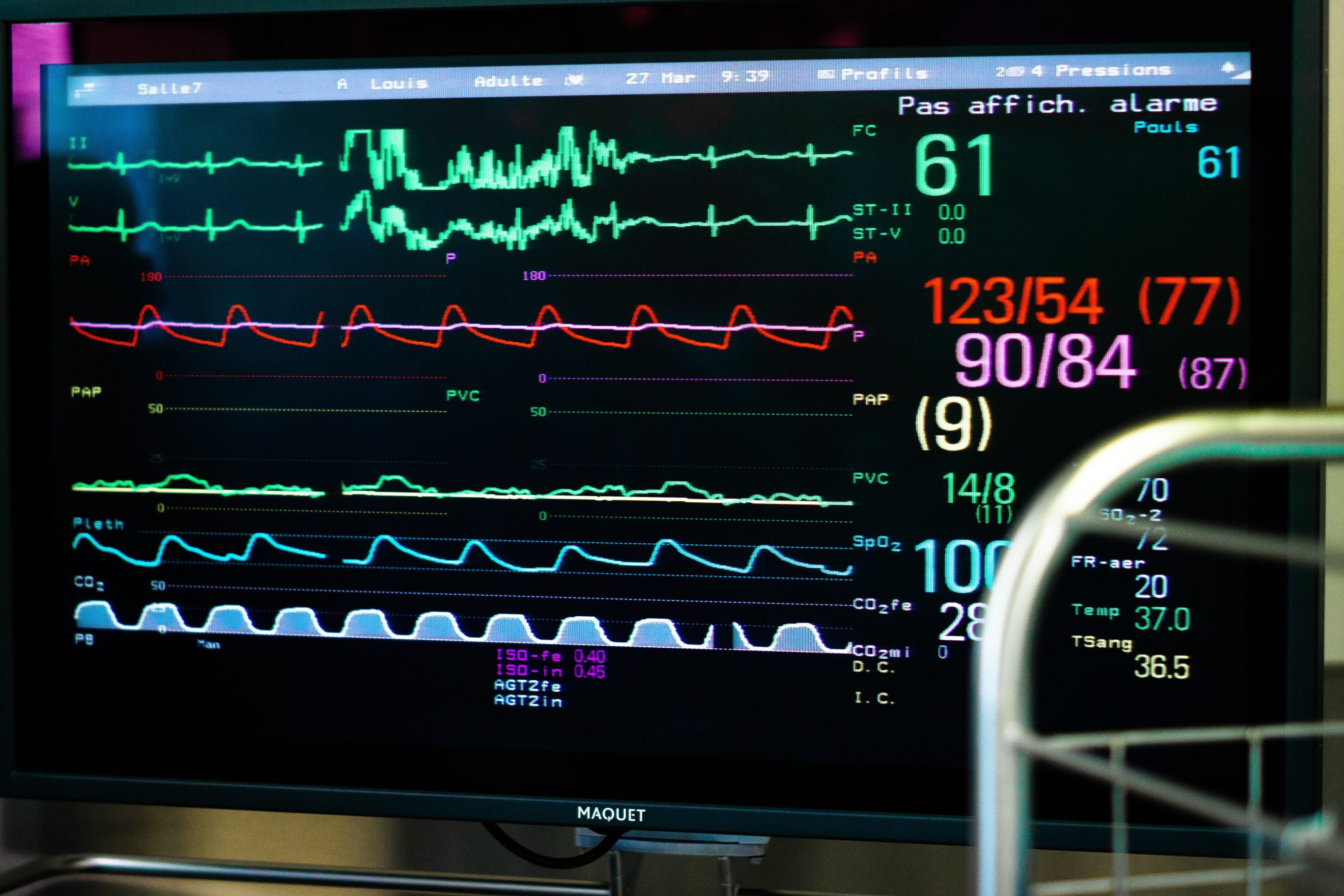 AI algorithm from the Heart Institute interprets ECGs better than a human